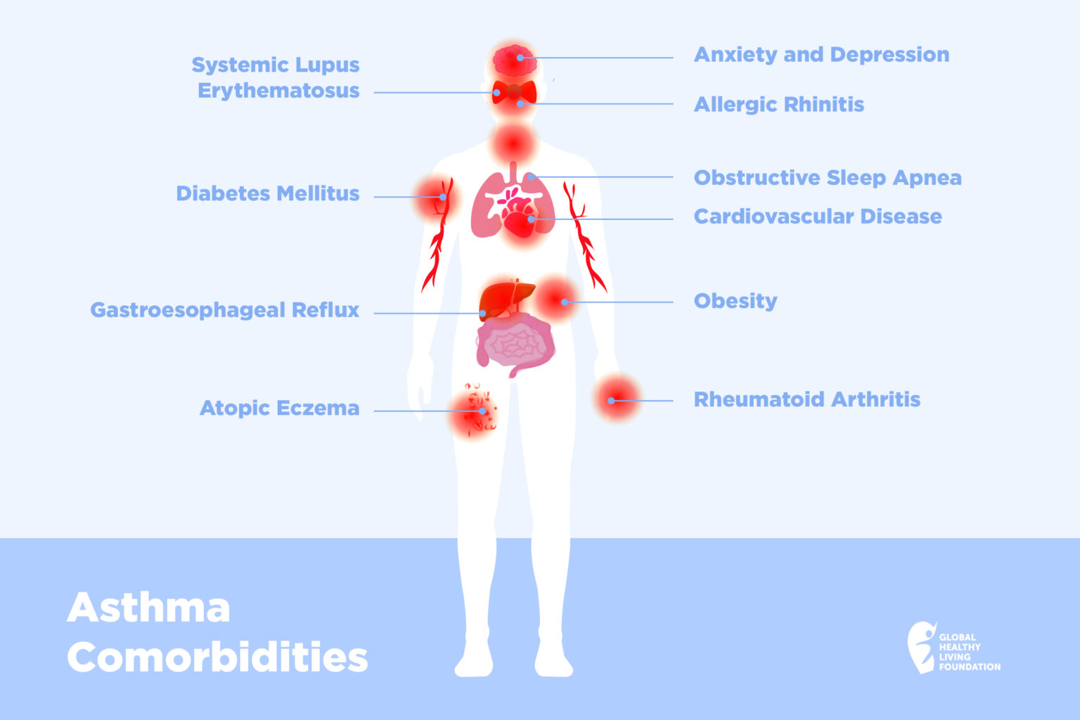 How to Tell Your Loved Ones About Your Asthma Diagnosis